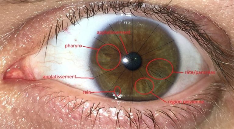 Iridologie : un autre regard sur la santé